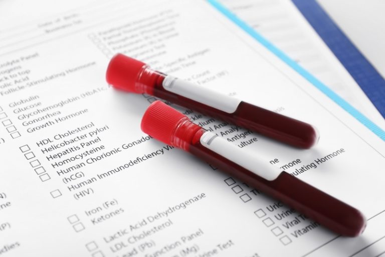 Transaminasi Alte: cosa sono, valori normali, cause, dieta e ...