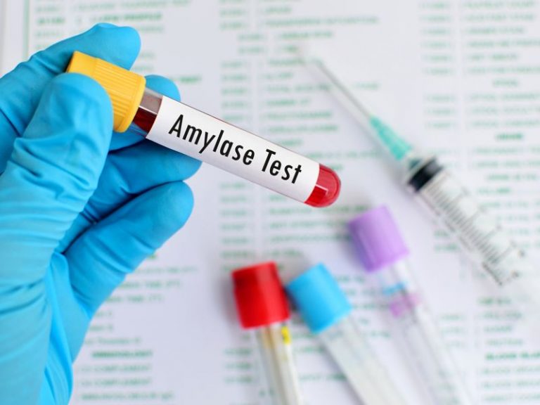 Amilasi alte in sangue o urine: cosa significa, conseguenze - Rivista ...