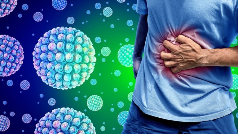 Virus intestinale: quali sono i sintomi della gastroenterite - Rivista ...